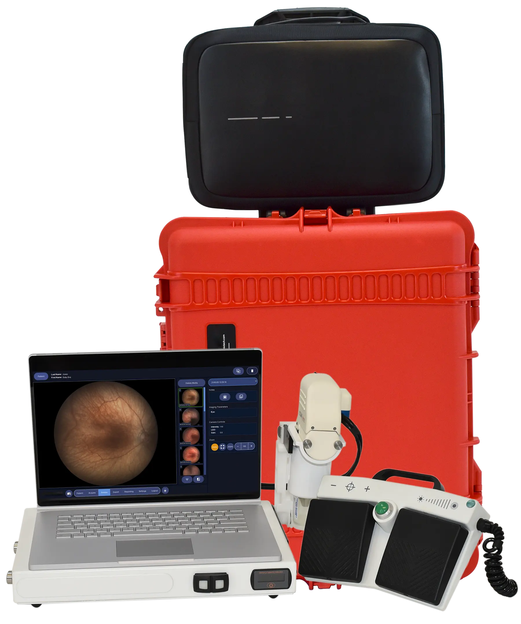 Icon GO Pediatric Retinal Imaging System